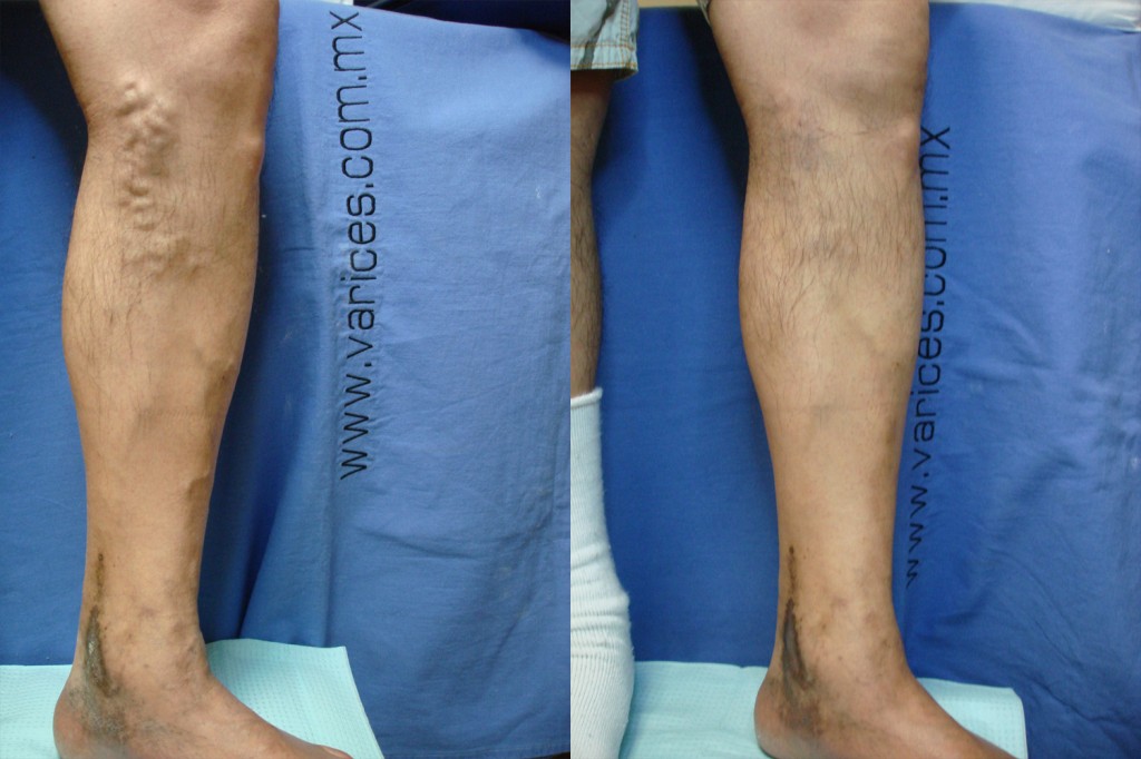 Galerias Archive - Dr. Rogelio Castañeda