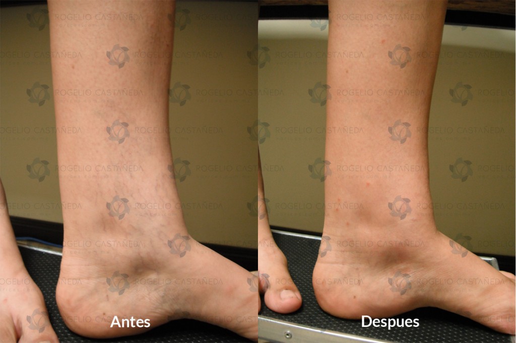 Galerias Archive - Dr. Rogelio Castañeda